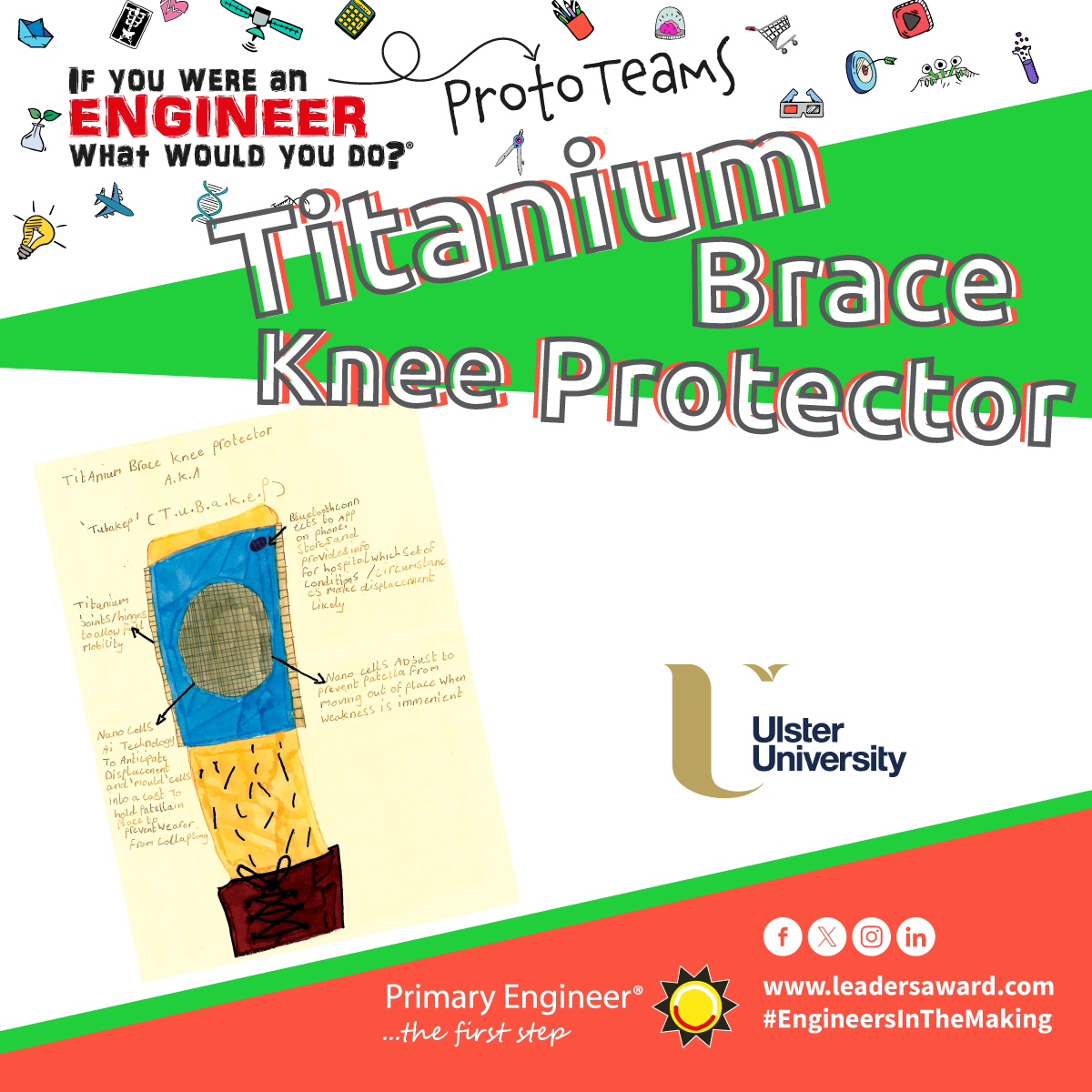 School pupil’s life changing Titanium Knee Brace Prototype Unveiled at ...